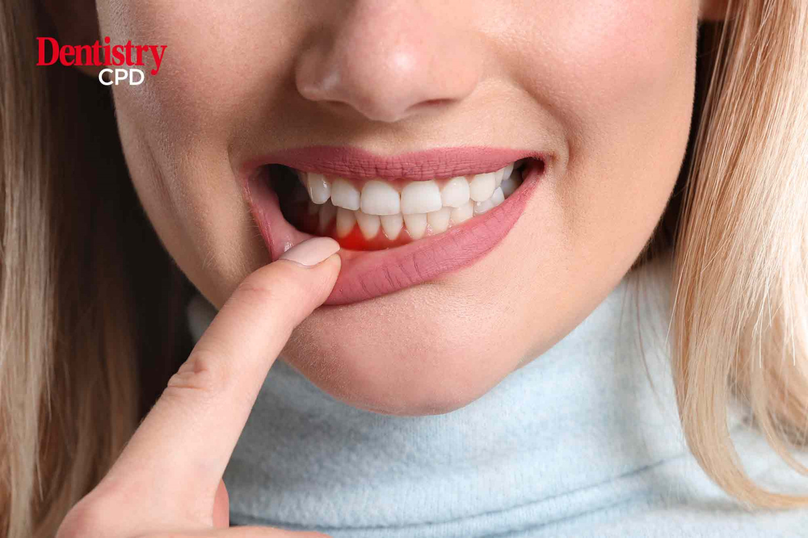 Dentistry CPD - Video: The stepwise approach to treating periodontitis ...