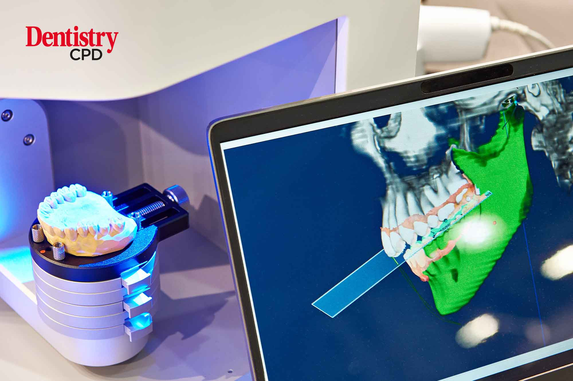 Dentistry CPD - Computer-aided implant planning and immediate loading