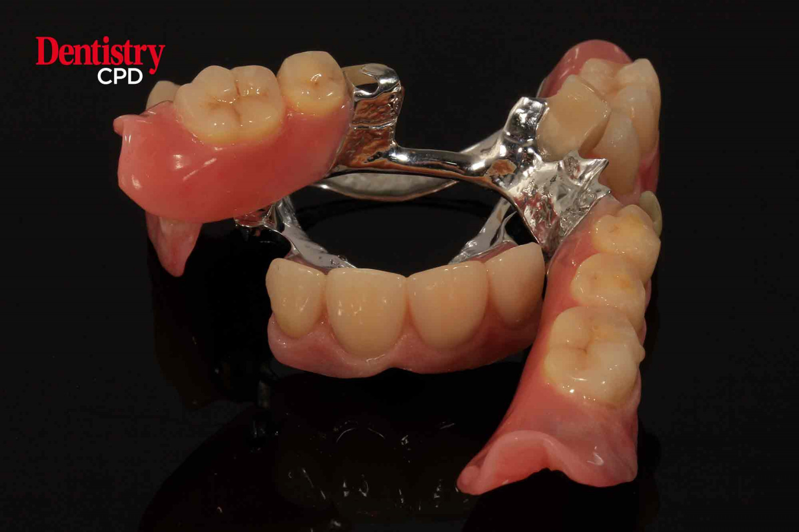 Dentistry CPD - Award-winning partial dentures