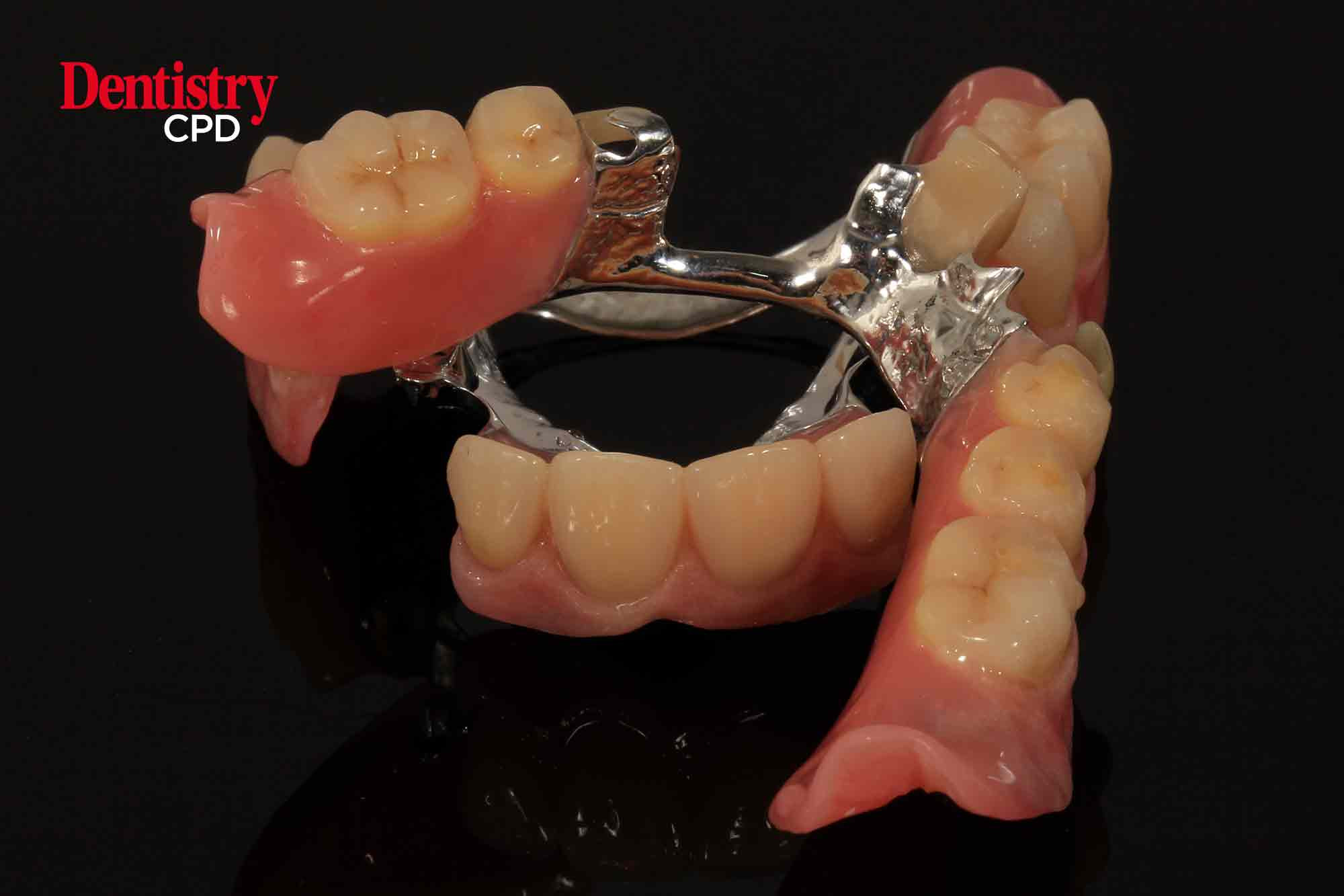 Dentistry CPD - Award-winning partial dentures