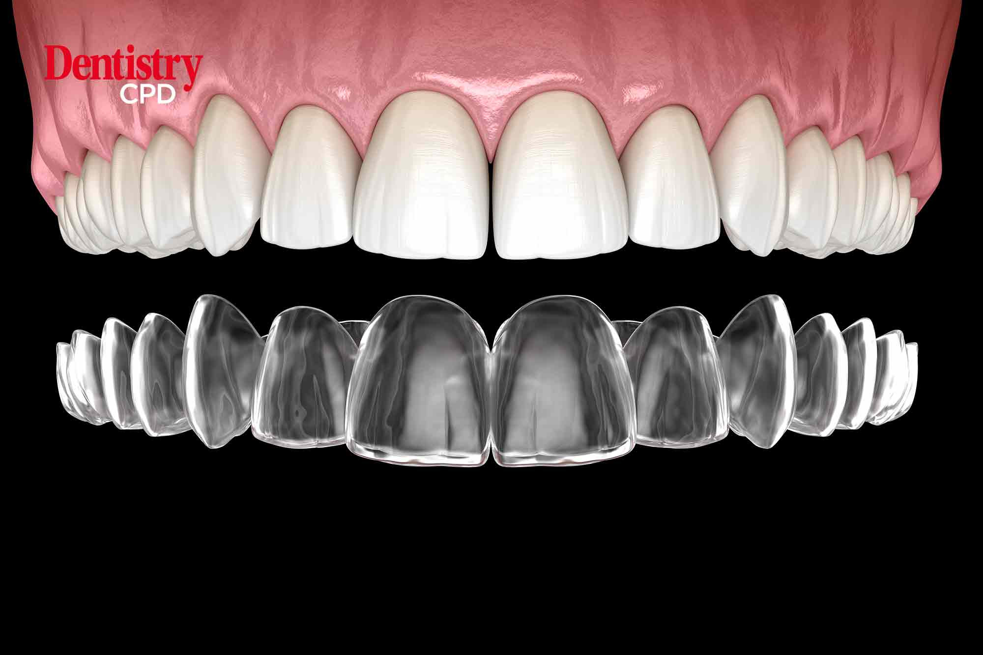 Dentistry CPD - 10 ways to grow Invisalign cases as an associate