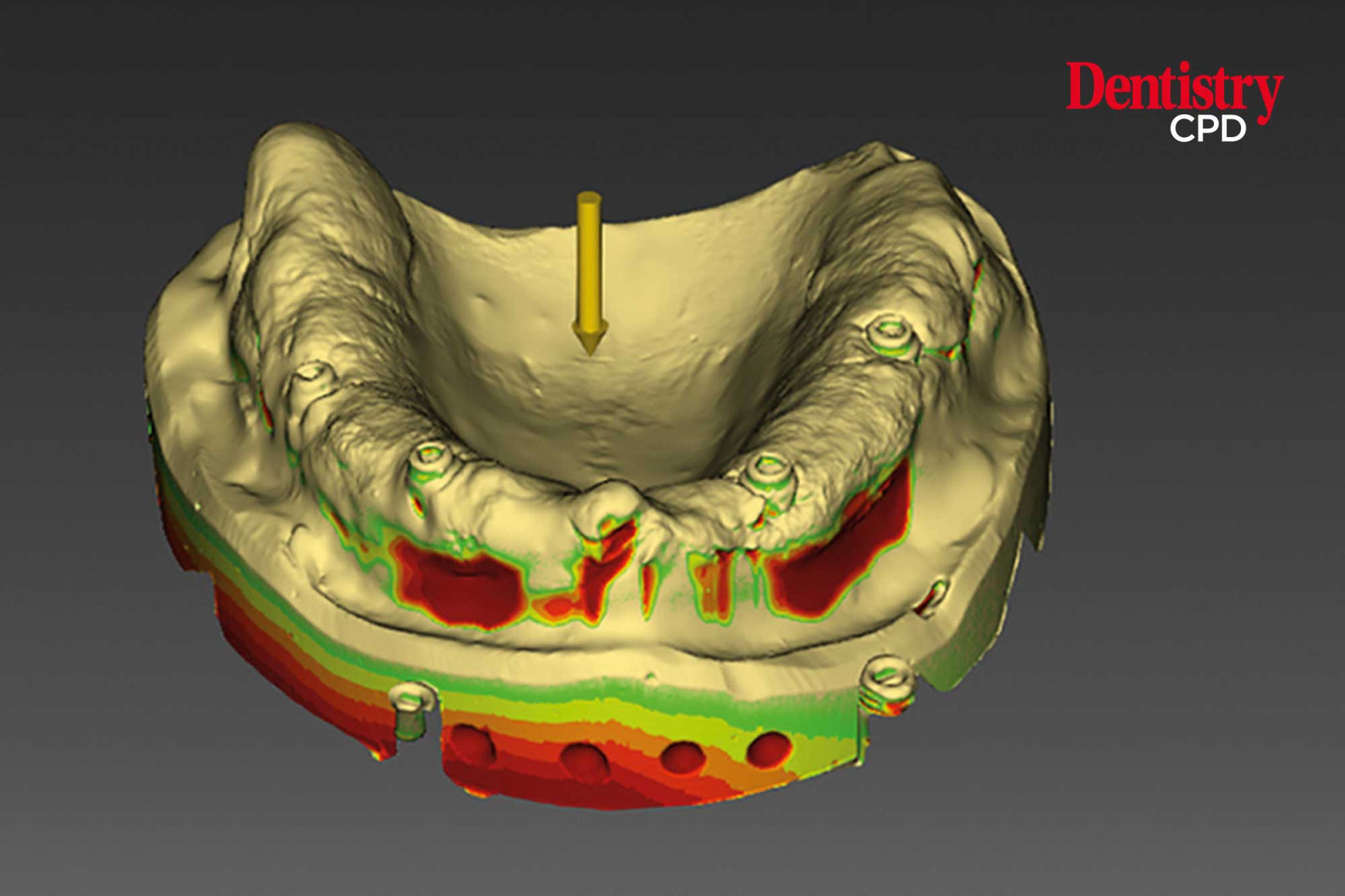 Dentistry CPD - 3D printing and dental technology: part one