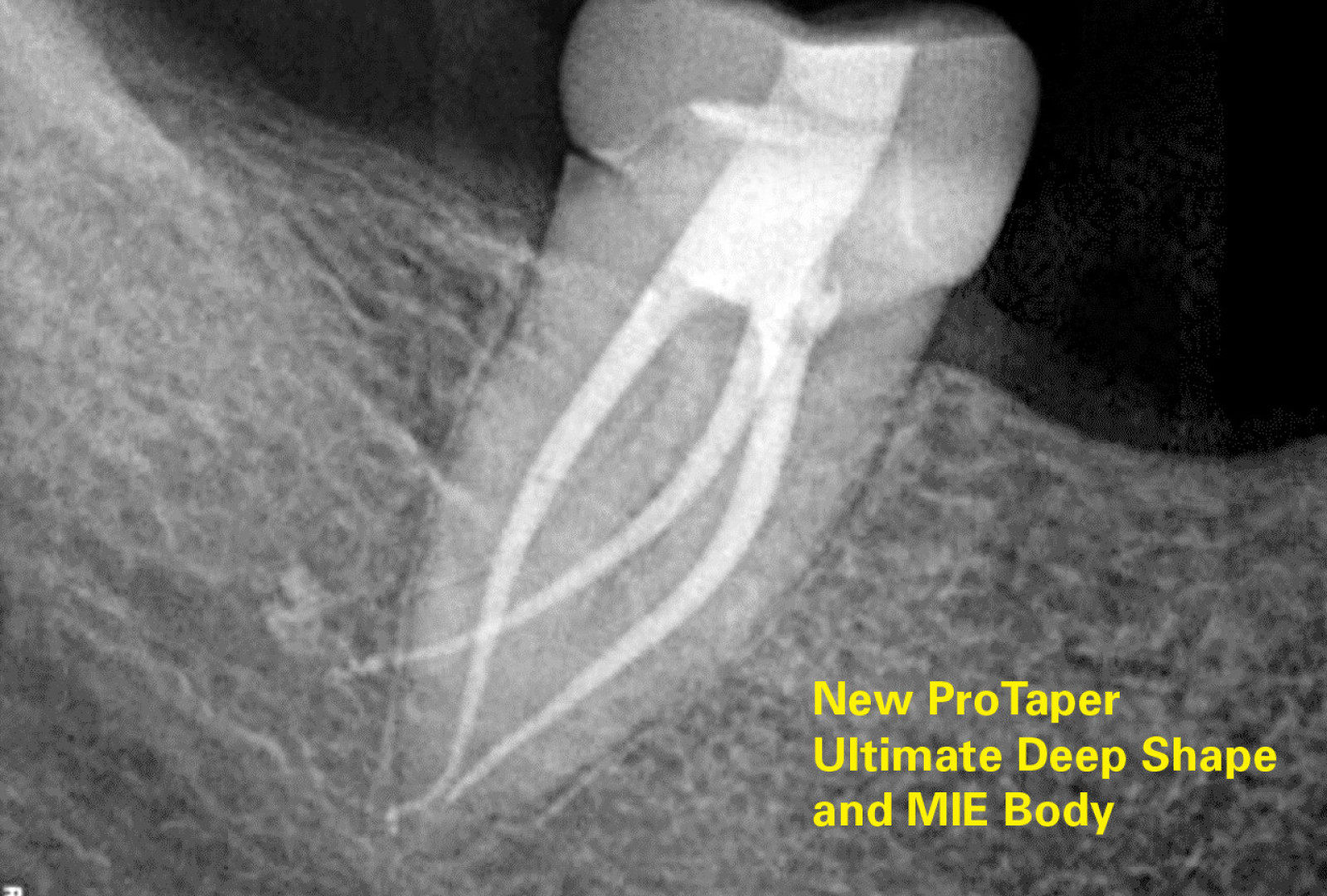 Dentistry CPD - Deep shape in endodontics