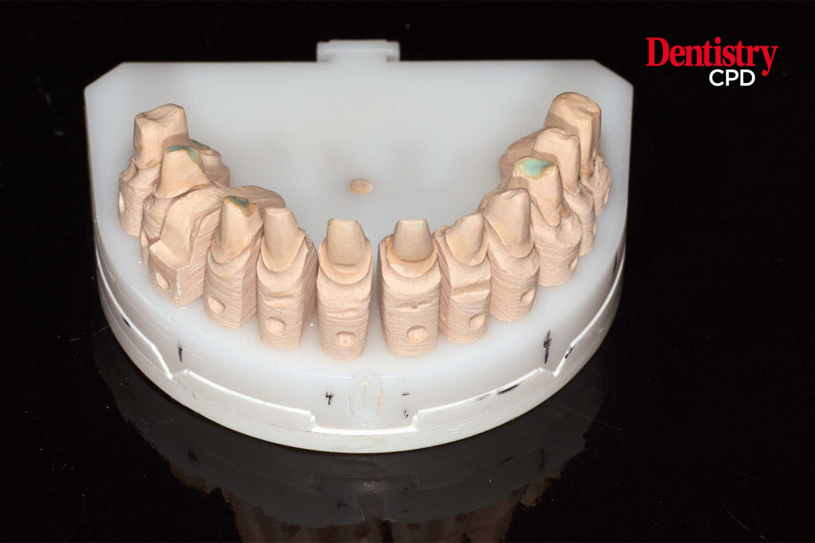 Dentistry CPD - Fabrication and cementation of monolithic crowns