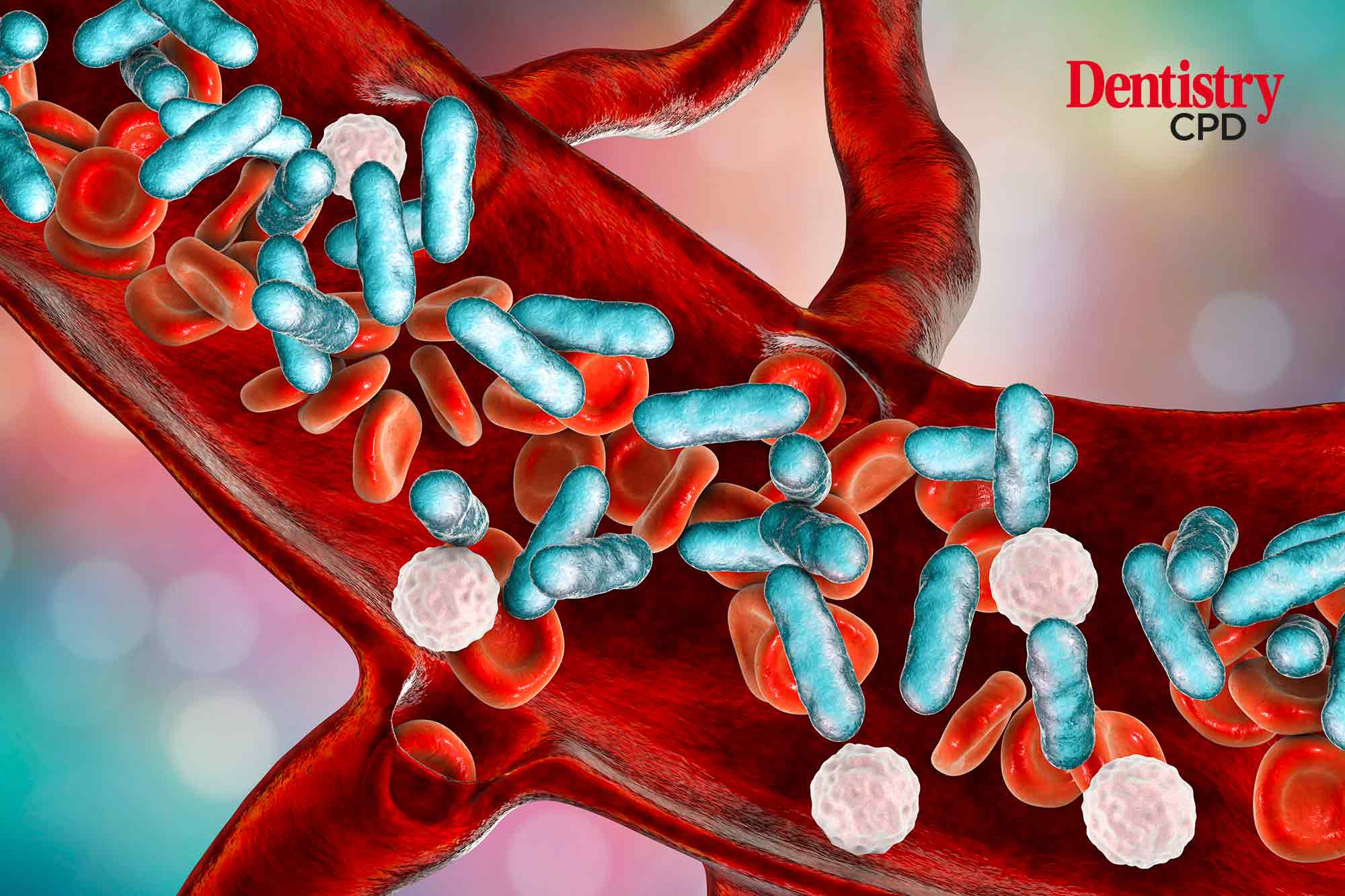Dentistry CPD - A guide to sepsis