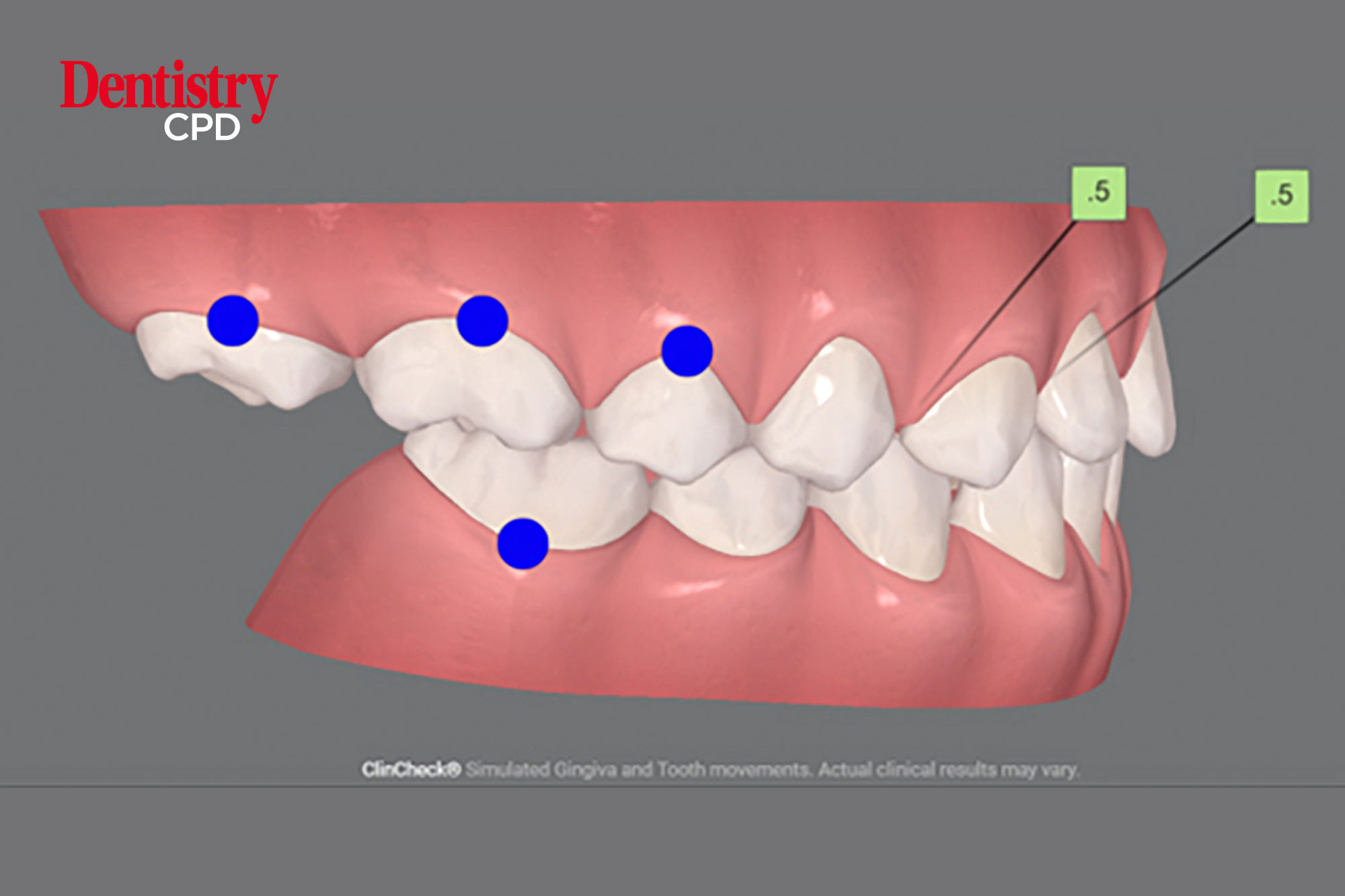 Dentistry CPD - Growth modification treatment in class II malocclusion