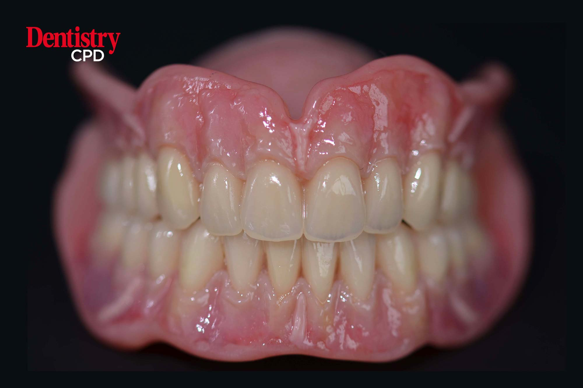 Dentistry CPD - Full mouth aesthetic denture case
