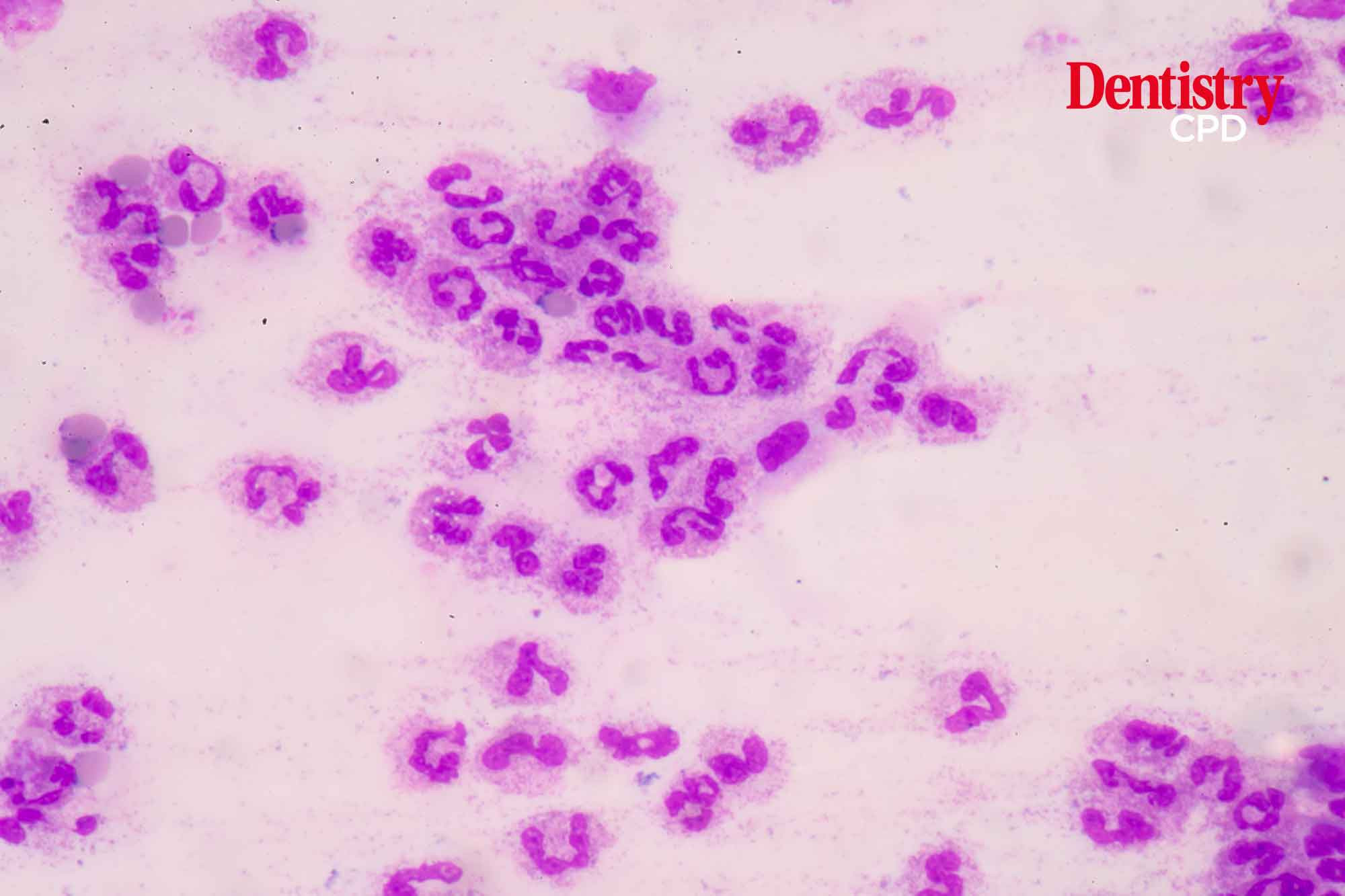 Dentistry CPD - Sepsis