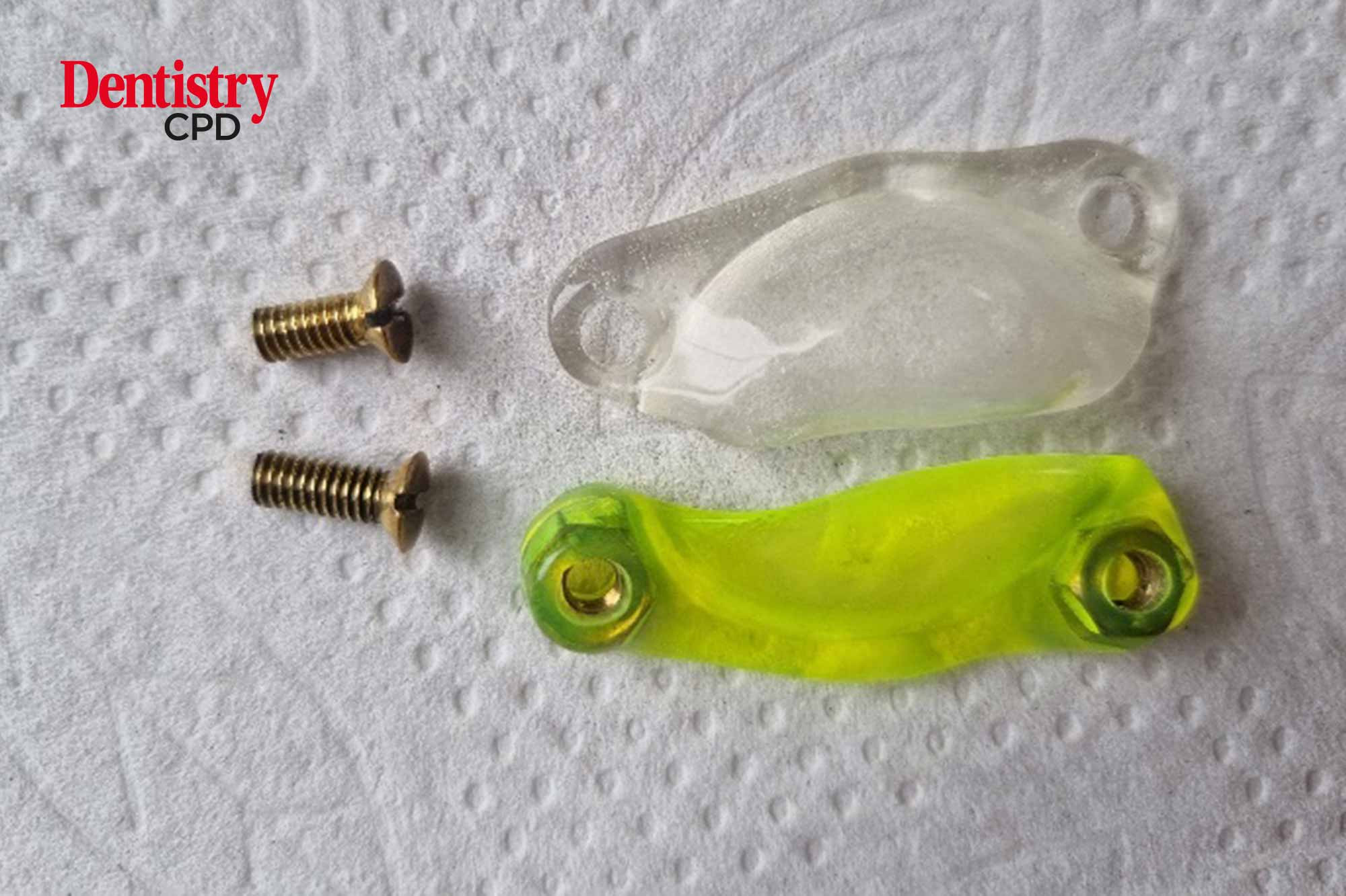 Dentistry CPD - Keloid splint compression therapy