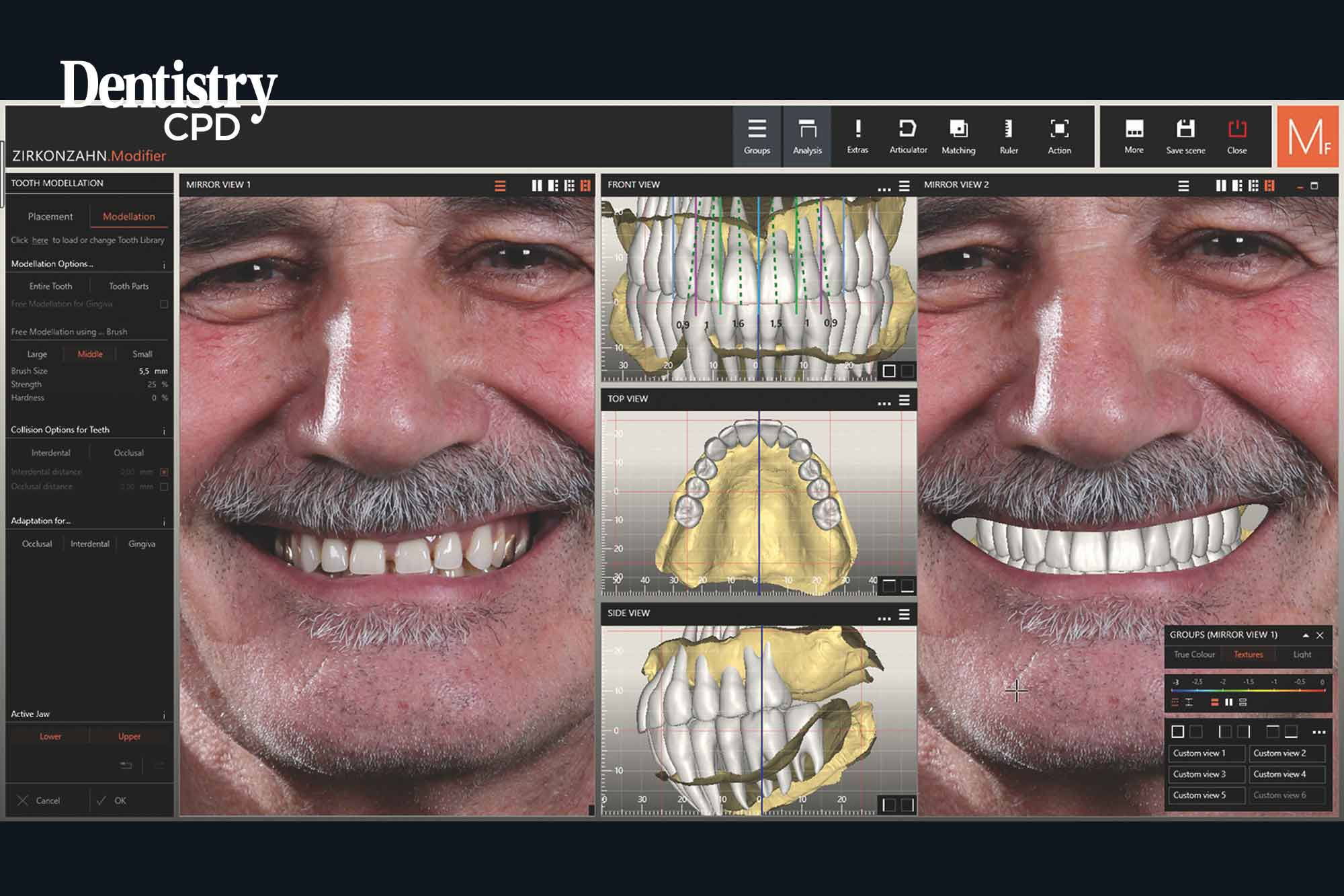 Dentistry CPD - Digital workflow for full dentures