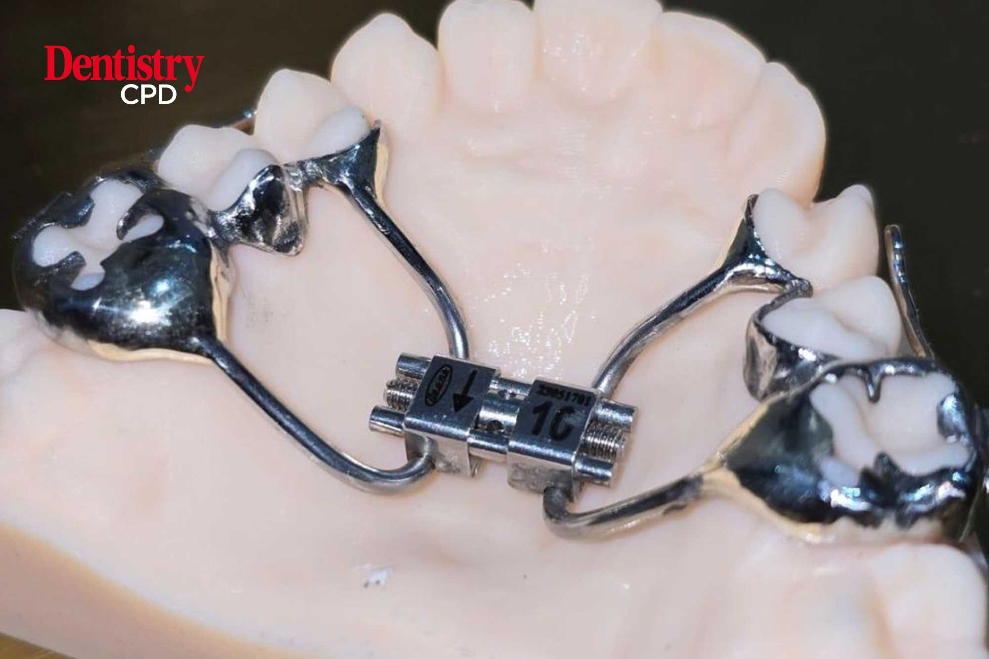 Dentistry CPD - Effective and discreet arch expansion