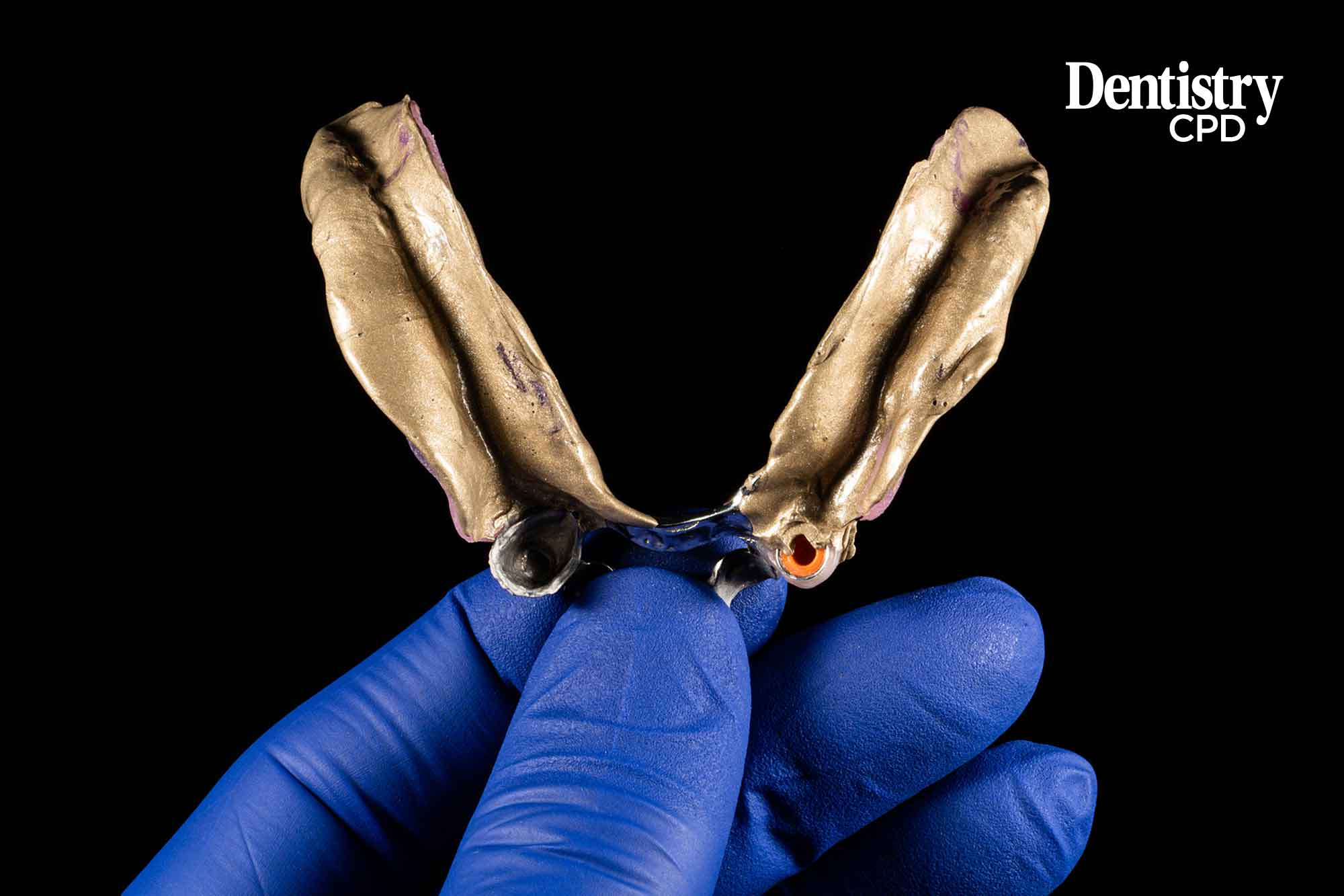 Dentistry CPD - Restorative dentistry: dentures