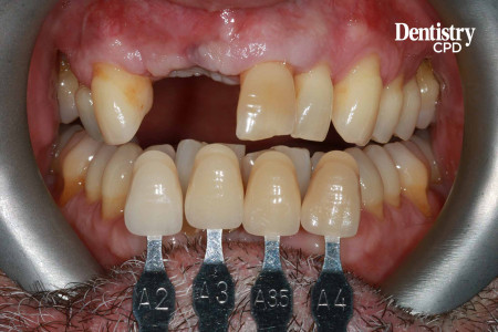 CPD for Dental Technicians | Dentistry CPD