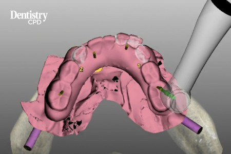 CPD for Dental Technicians | Dentistry CPD
