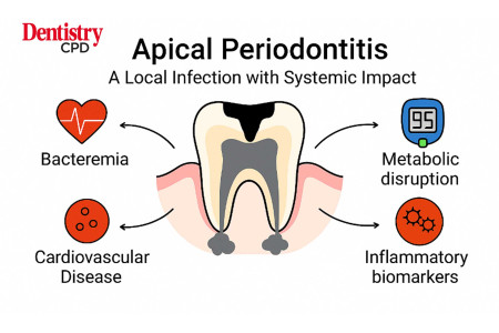 CPD for Dental Nurses | Easy to Complete | 500+ Hours Of Dental Nurse ...