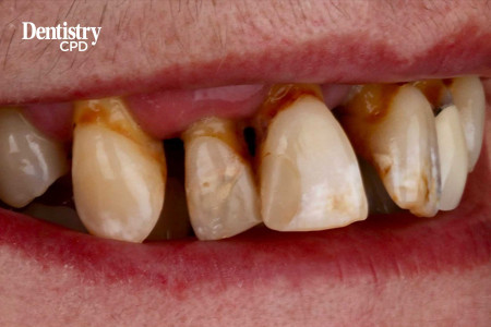 CPD for Dental Nurses | Easy to Complete | 500+ Hours Of Dental Nurse ...