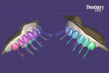CPD for Dental Nurses | Easy to Complete | 500+ Hours Of Dental Nurse ...